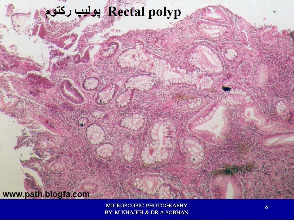 نخستین آزمايشگاه آسيب شناسي اینترنتی